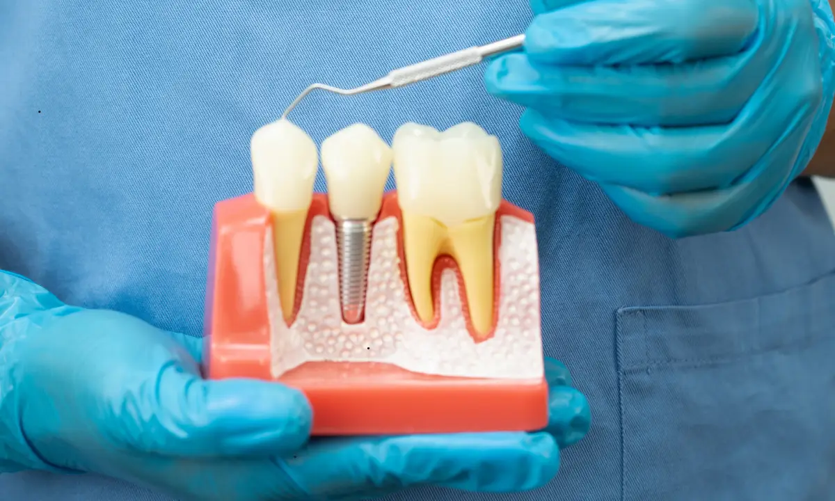 How to Prevent a Root Canal with Oral Care & Early Action